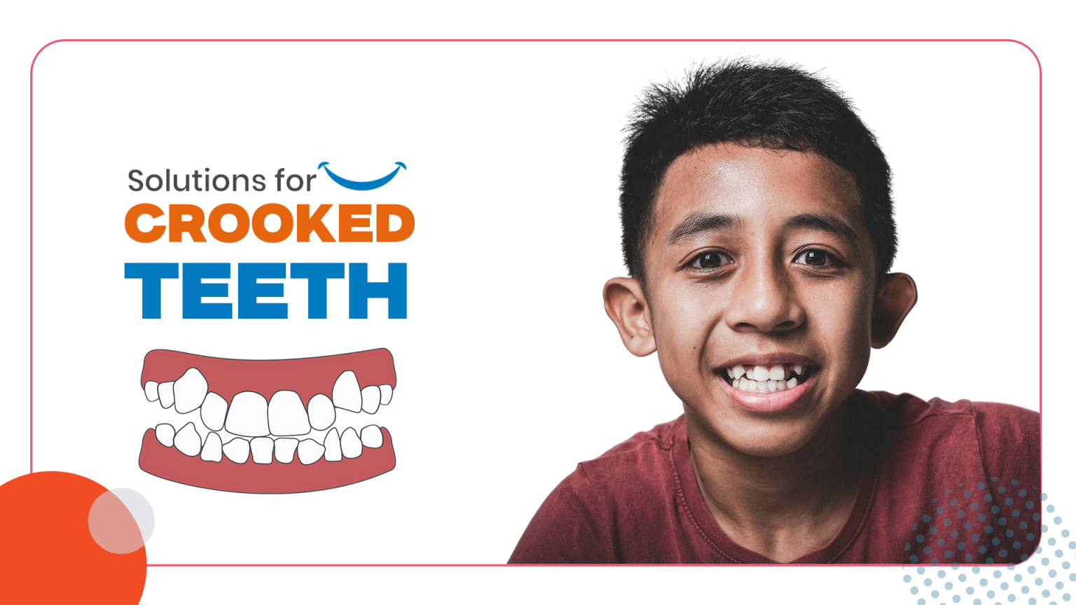 Best Solutions for Crooked Teeth | TOOT Dental